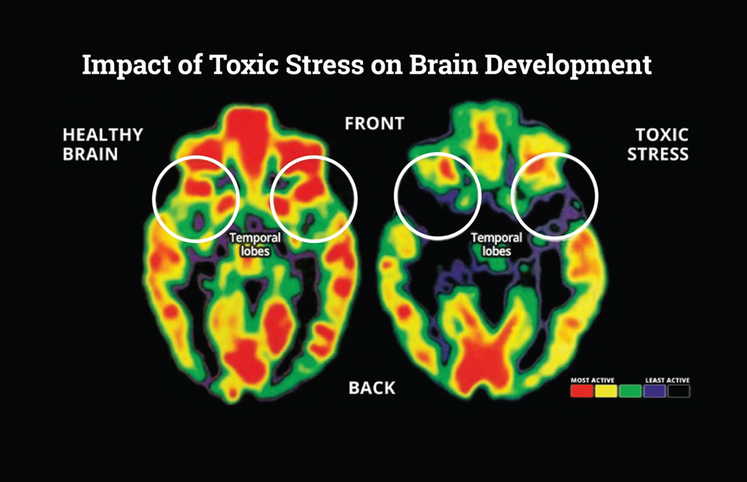 toxic stress – Teaching With Magic